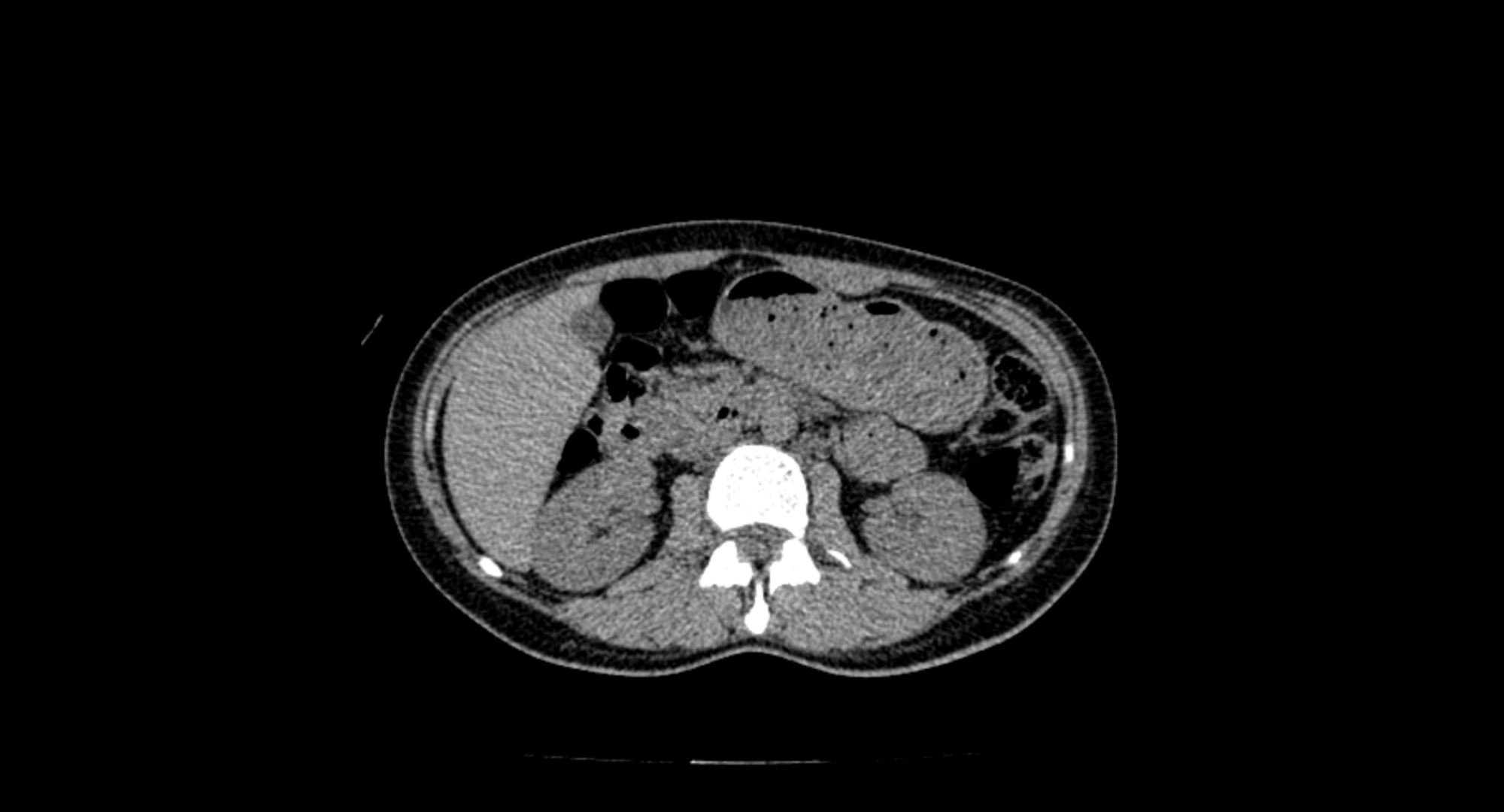 Product – Ldspharma